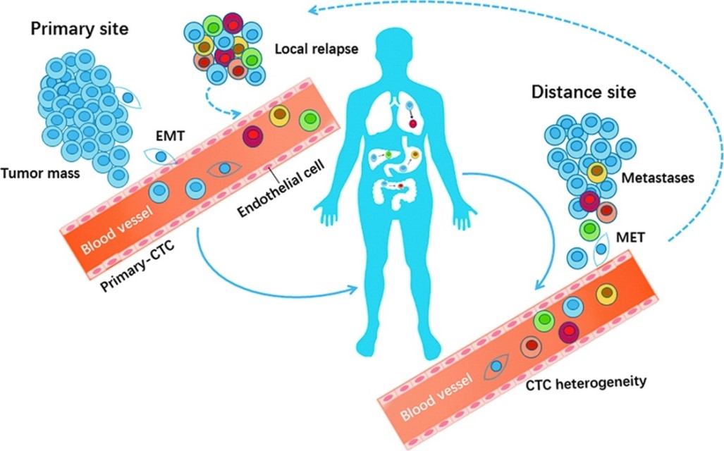 이미지: [CTC(circulating tumor cell) 소개 및 전이과정에서의 CTC의 역할]